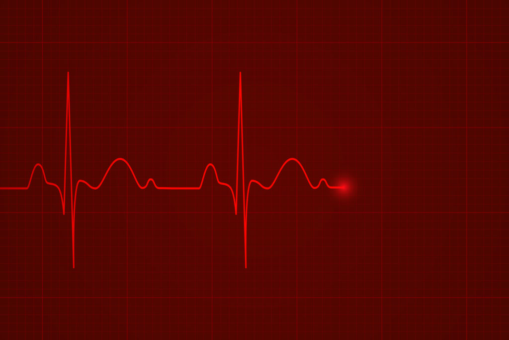 L'elettrocardiografo o ecg: lo strumento per scoprire la salute del cuore