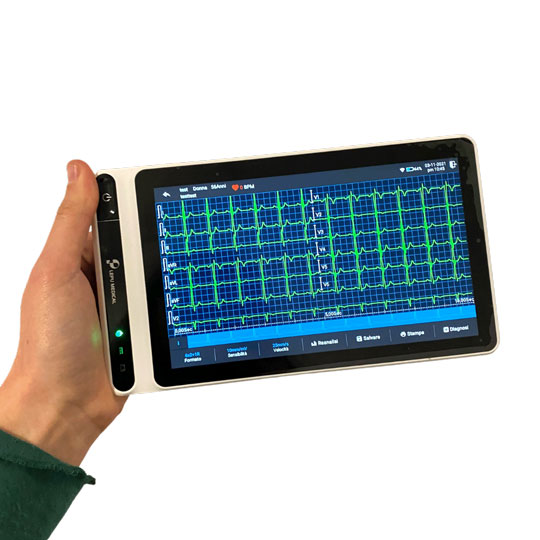Elettrocardiografo tablet ecg portatile 12 derviazioni interpretazione ...