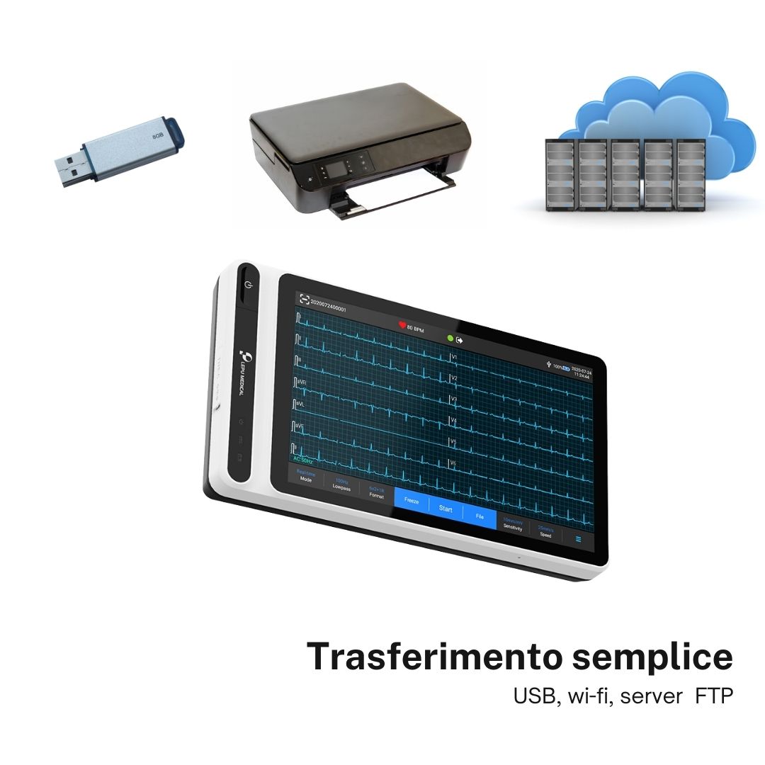 Elettrocardiografo tablet ecg portatile 12 derviazioni interpretazione ...